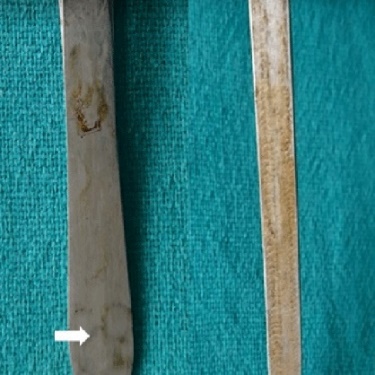 Corrosion and medical equipment | Thai Amtec Co., Ltd.